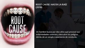 "Root Cause: Hasta la raíz" | webdental.cl | Noticias de Odontologia
